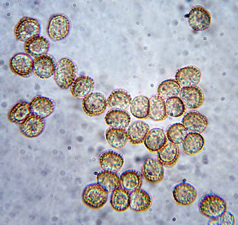 Spore Microscope Salori